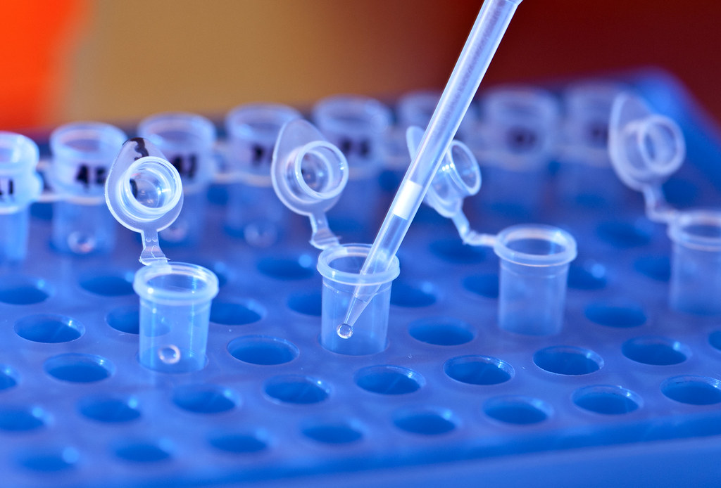 Germany's Intu Diagnostics raises €1.1M for lab-free infection tests ...